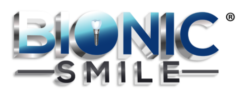 Bionic Smile Full Arch Implants