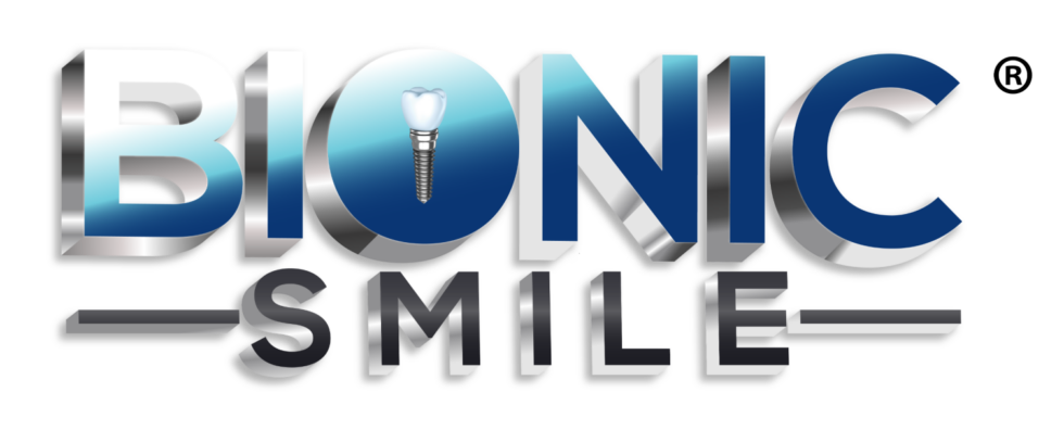 Bionic Smile Full Arch Implants