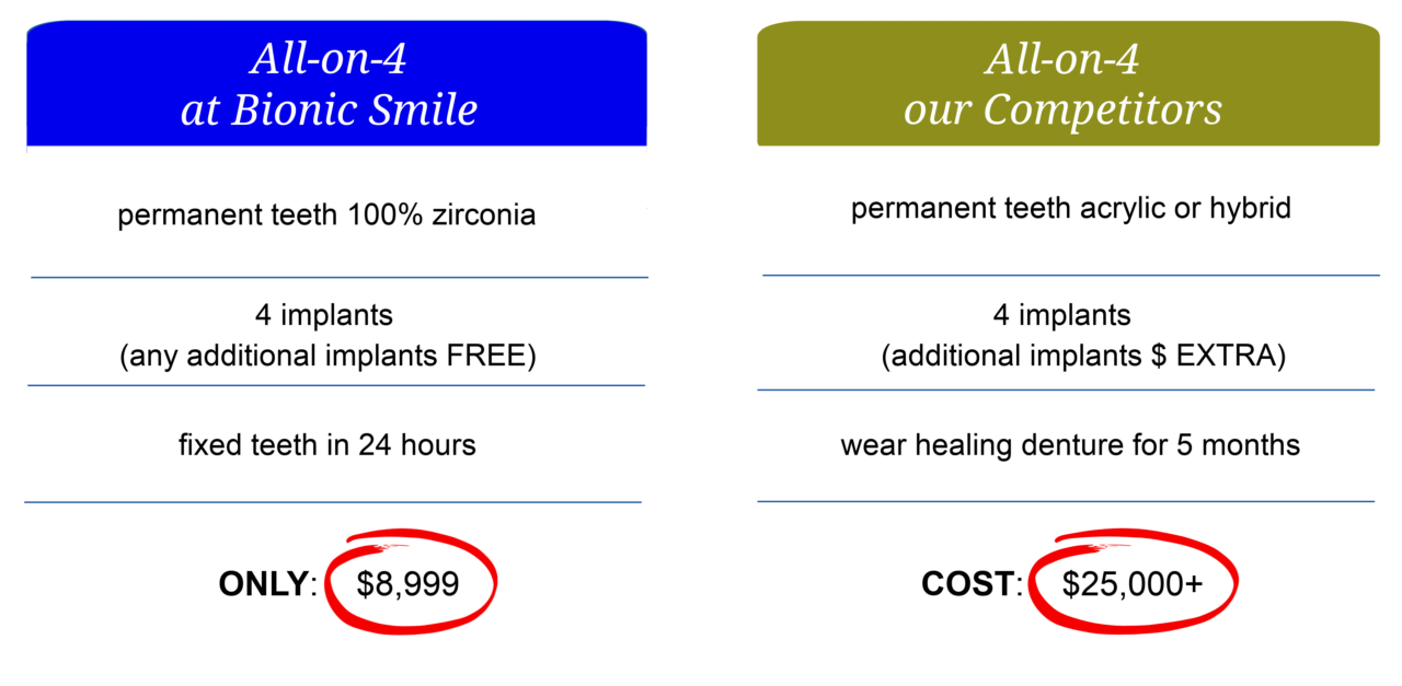 Bionic Smile Full Arch Implants